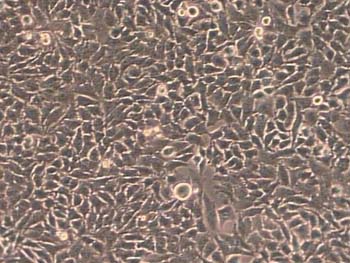 Cellules hela; Cellule HeLa; Lignée cellulaire HeLa; Lignée HeLa